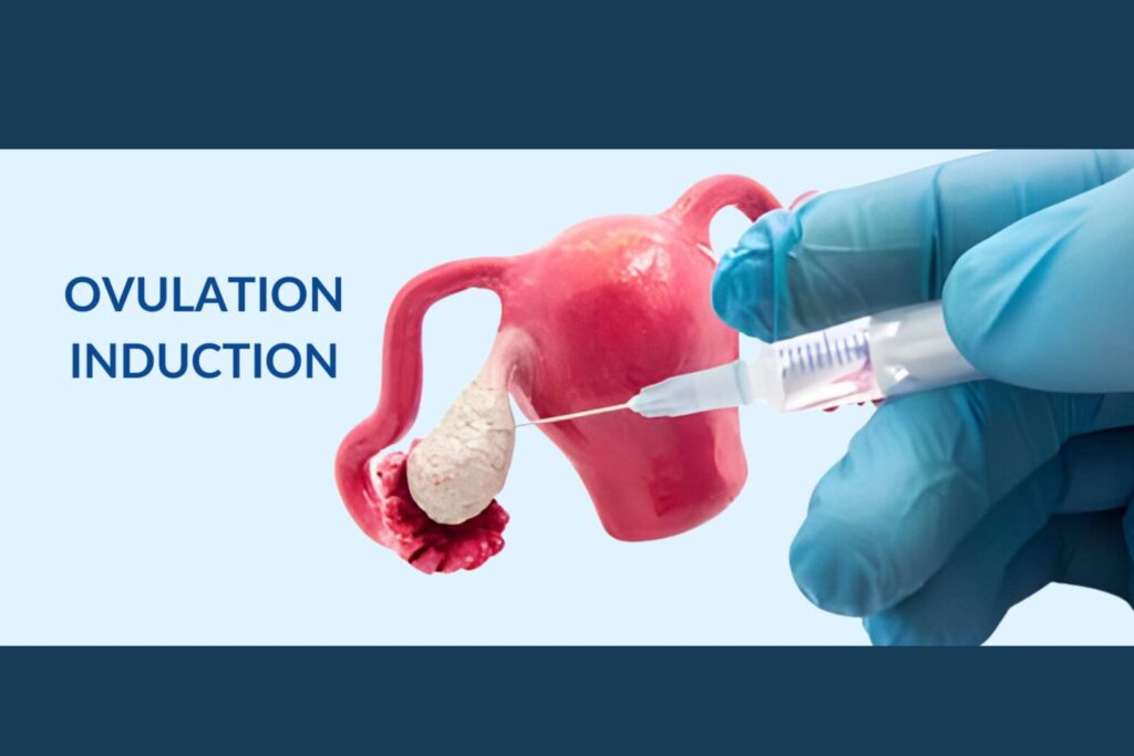 Ovulation Induction - Suraksh Hospital